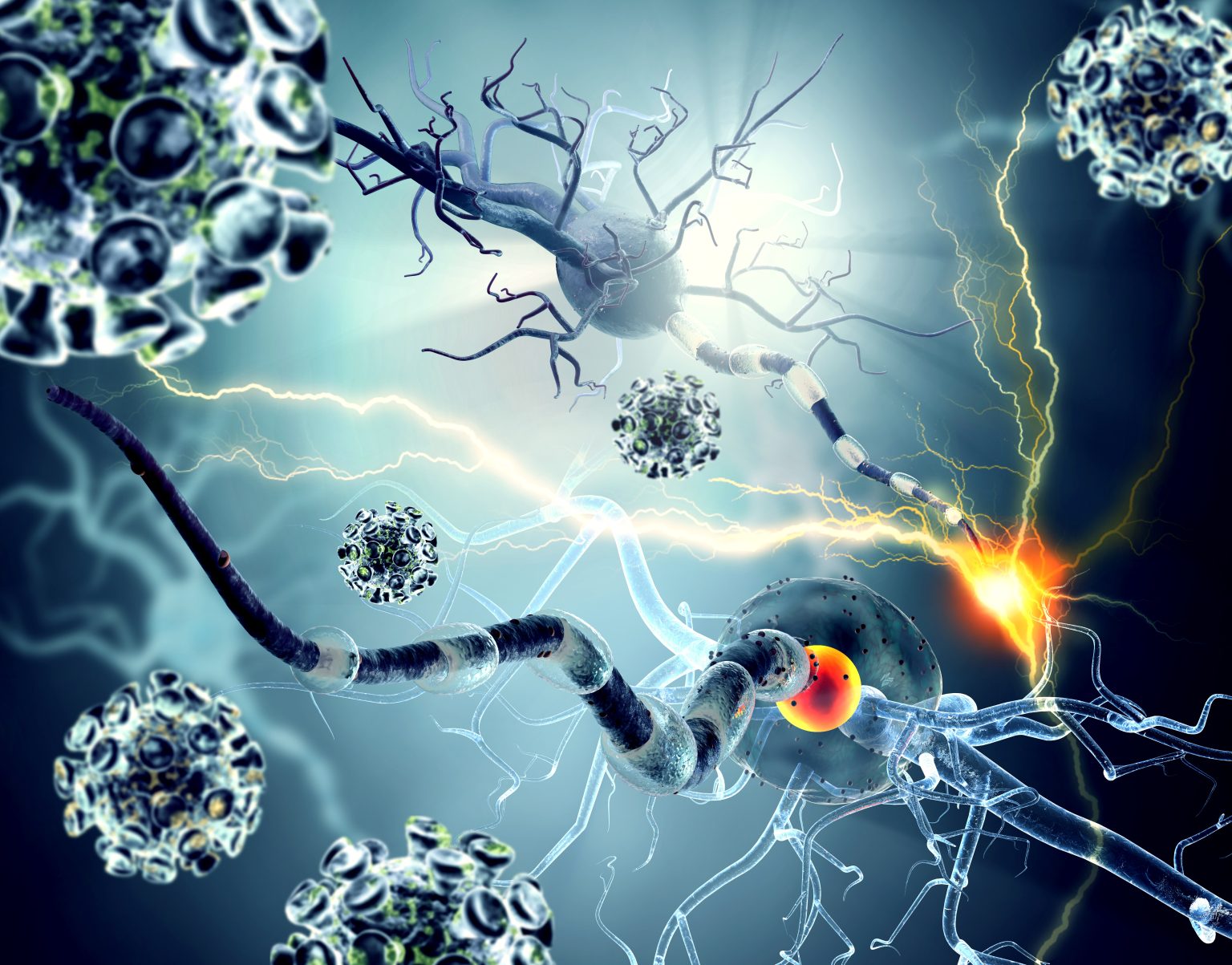 Which Types of Accidents Can Lead to Permanent Nerve Damage? - Merkel ...
